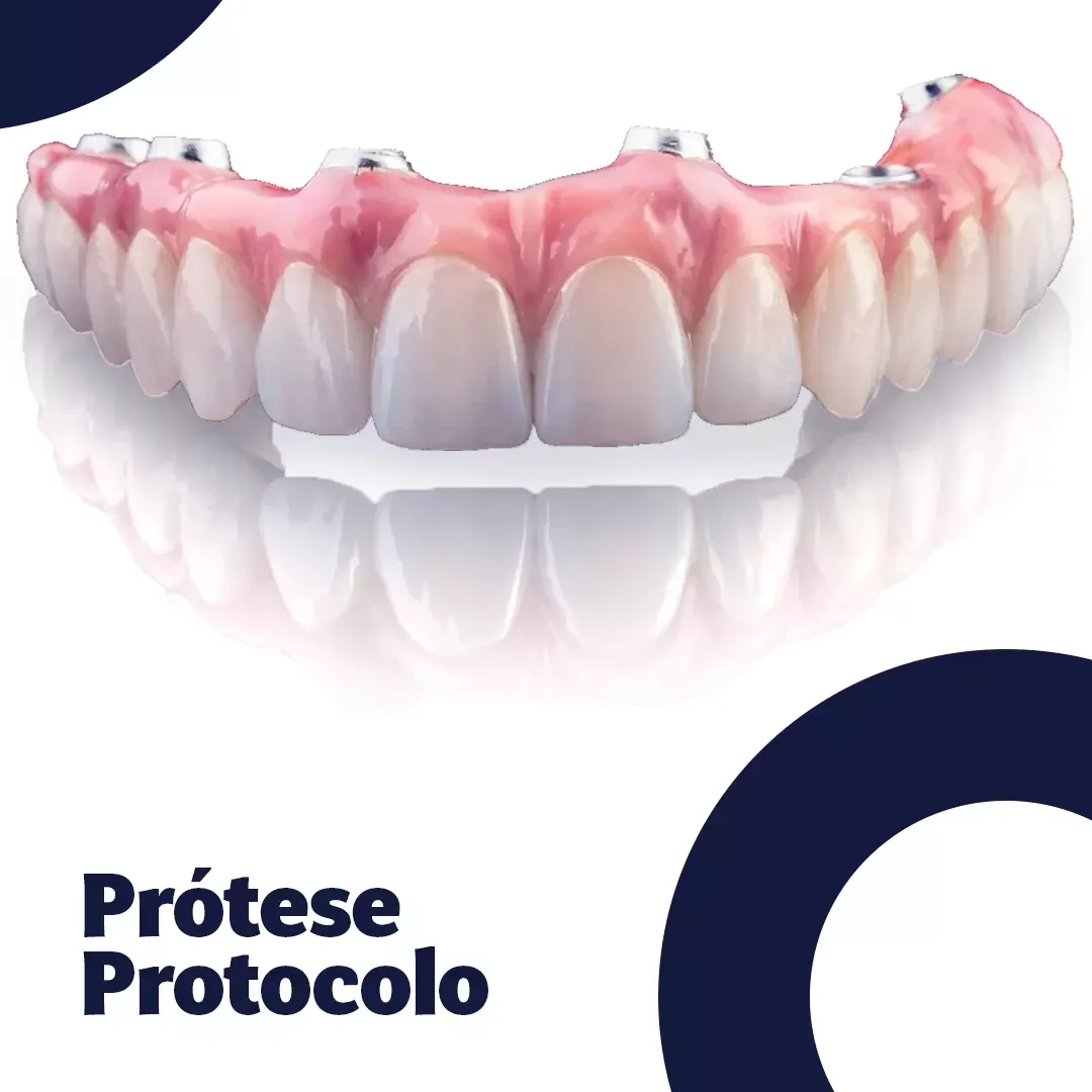 Revívity Odontologia – Prótese Protocolo | Campinas/SP